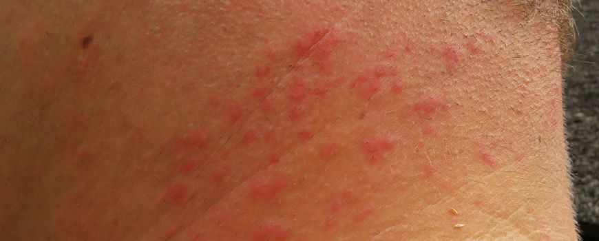 Nature Today | Plaatselijk veel meer eikenprocessierupsen